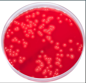 Kingella Growth On Blood Agar