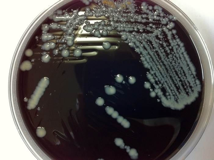 Microaerophilic /Anaerobic agar line - HyLabs